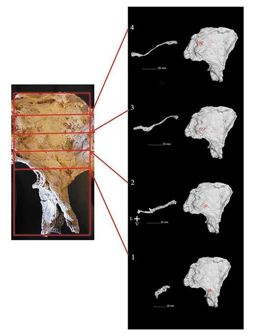 StW 573 Australopithecus prometheus: Its Significance for an ...