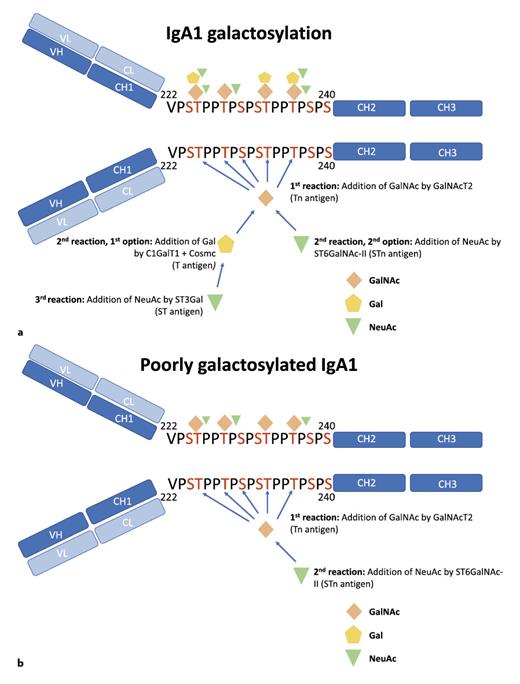 New Insights into the Pathogenesis and Treatment Strategies in IgA ...