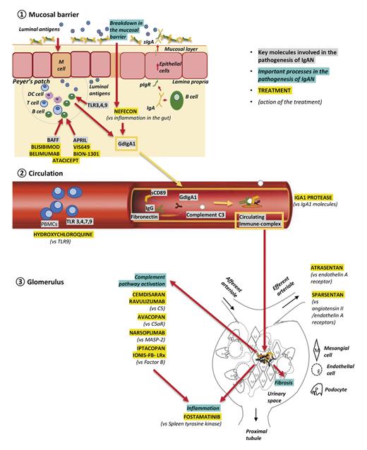 New Insights into the Pathogenesis and Treatment Strategies in IgA ...