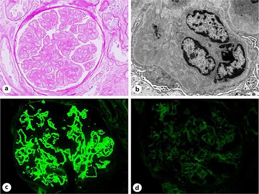 The Clinical and Pathological Characteristics of Patients with ...