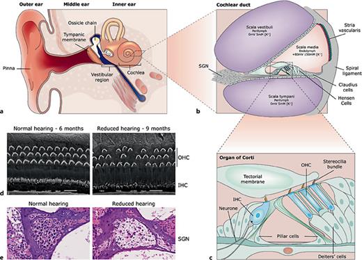 The Mouse as a Model for Age-Related Hearing Loss - A Mini-Review ...