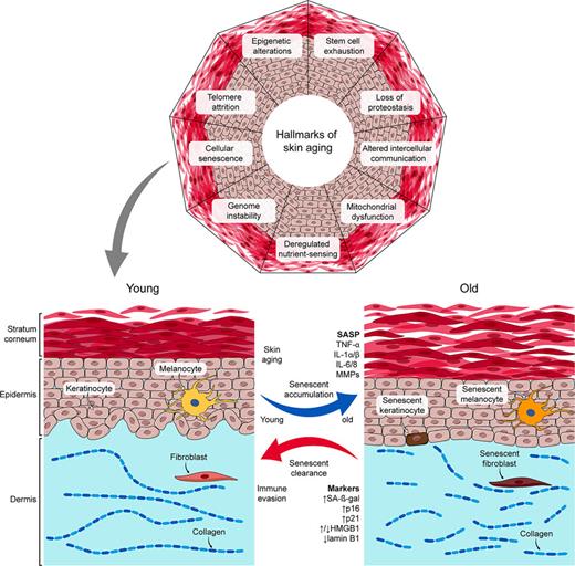 Cellular Senescence in Human Skin Aging: Leveraging Senotherapeutics ...