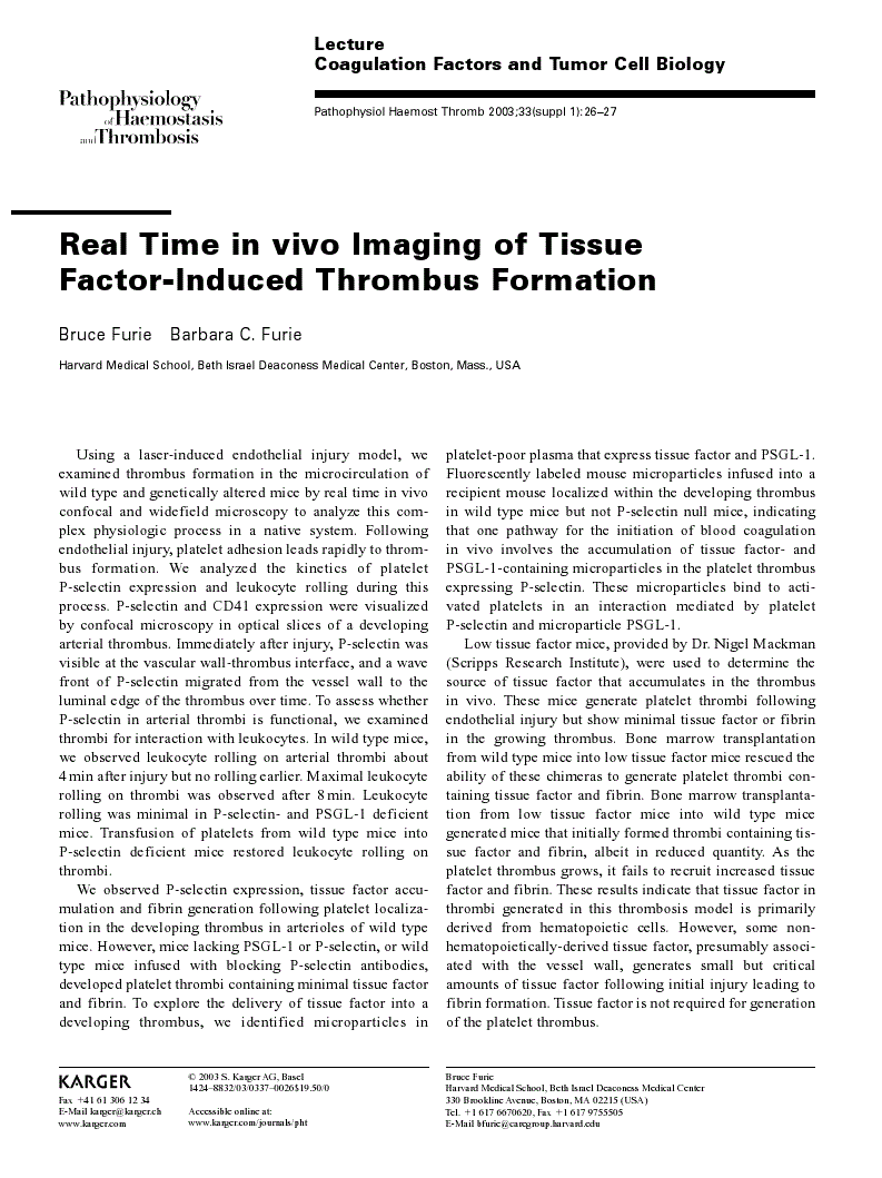 Real Time in vivo Imaging of TissueFactor-Induced Thrombus Formation ...