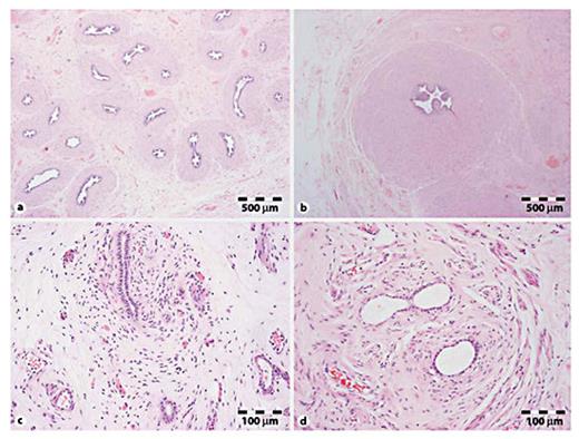 Regulation of Wolffian Duct Development | Hormone Research in ...