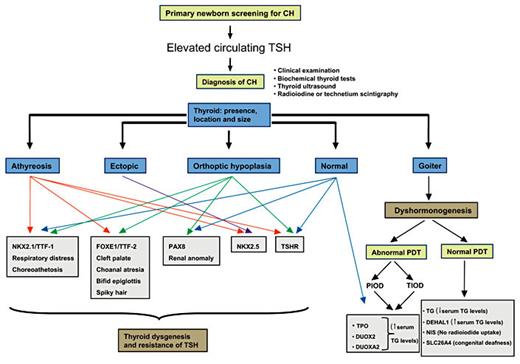 Thyroglobulin Gene Mutations in Congenital Hypothyroidism | Hormone ...