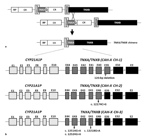 Tenascin-X, Congenital Adrenal Hyperplasia, and the CAH-X Syndrome ...