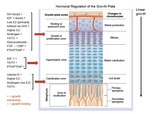Evolution and Future of Growth Plate Therapeutics | Hormone Research in ...