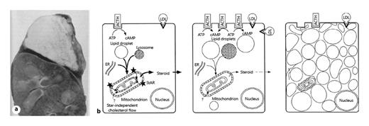 A Brief History of Congenital Adrenal Hyperplasia | Hormone Research in ...