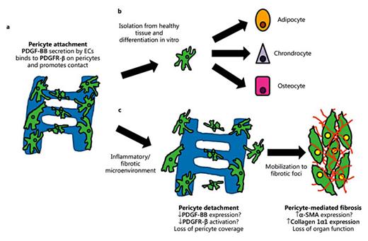 Pericytes in Chronic Lung Disease | International Archives of Allergy ...