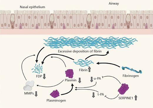 Research Progress on the SERPINE1 Protein and Chronic Inflammatory ...