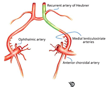 Anterior Communicating Artery Aneurysm Treatment with the Pipeline ...