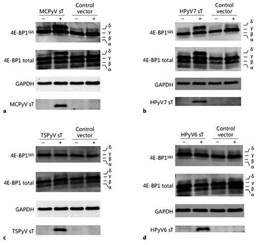 Cutaneous Human Polyomavirus Small T Antigens and 4E-BP1 Targeting ...