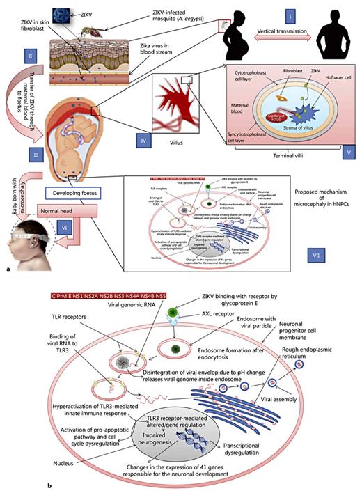 Zika Virus-Induced Microcephaly and Its Possible Molecular Mechanism ...