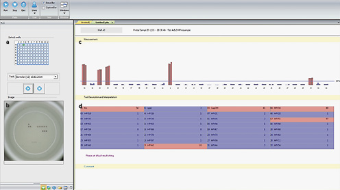Analytical Evaluation of the Human Papillomavirus HPV DNA Array E1 ...