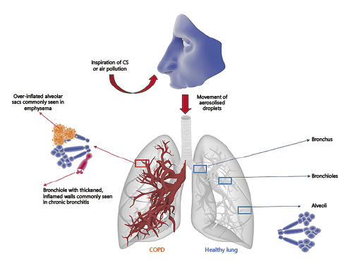 Animal Models Reflecting Chronic Obstructive Pulmonary Disease and ...