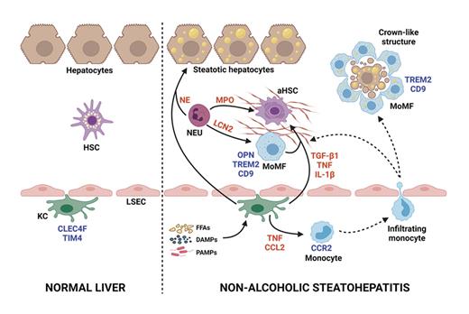 The Role of Innate Immune Cells in Nonalcoholic Fatty Liver Disease ...