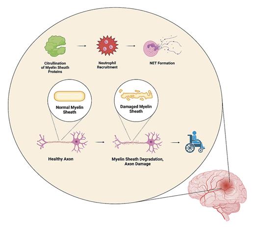 The Citrullination-Neutrophil Extracellular Trap Axis in Chronic ...