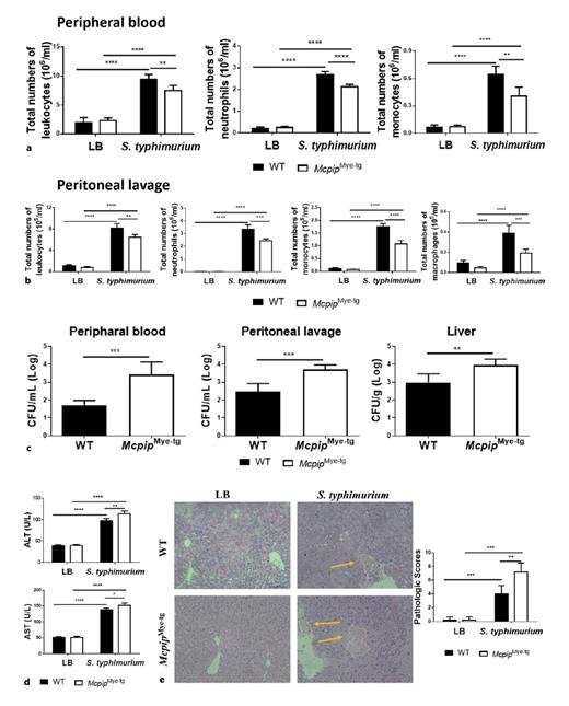 MCPIP-1-Mediated Immunosuppression of Neutrophils Exacerbates Acute ...