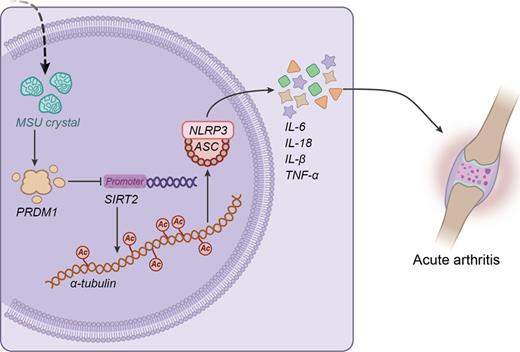 Pro-Inflammatory of PRDM1/SIRT2/NLRP3 Axis in Monosodium Urate-Induced ...