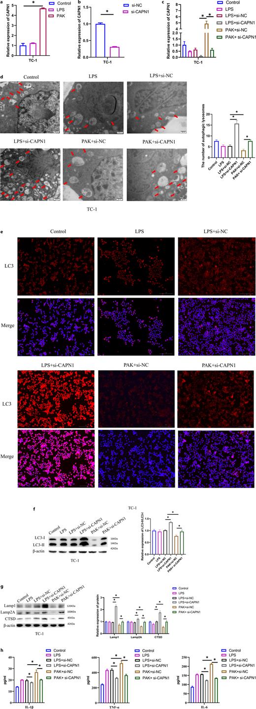 CAPN1 Promotes Pseudomonas aeruginosa-Induced Infection by Interacting ...