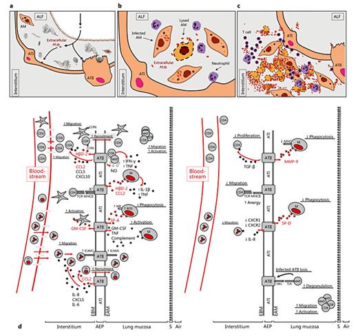 Alveolar Epithelial Cells in Mycobacterium tuberculosis Infection ...