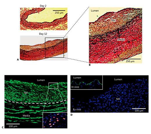 Prevention of Venous Neointimal Hyperplasia by a Multitarget Receptor ...