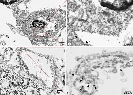 Plasmalemmal Vesicle-Associated Protein Is Associated with Endothelial ...