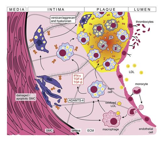 The Role of ADAMTS-4 in Atherosclerosis and Vessel Wall Abnormalities ...