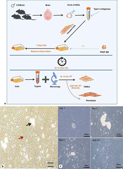 Isolation and Cultivation of Vascular Smooth Muscle Cells from the ...