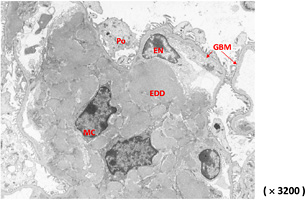 Pathogenesis and Treatment of Chronic Kidney Disease: A Review of Our ...