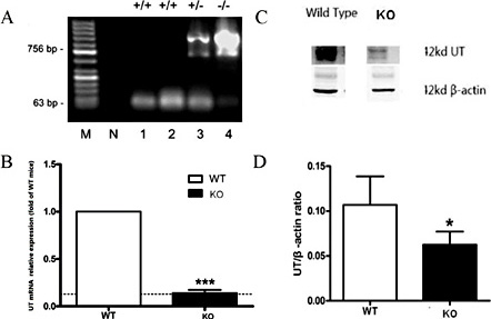 Urotensin II Induces ER Stress and EMT and Increase Extracellular ...