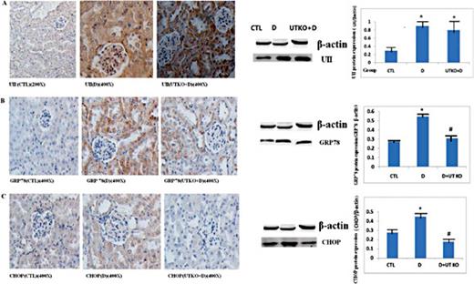 Urotensin II Induces ER Stress and EMT and Increase Extracellular ...