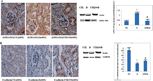 Urotensin II Induces ER Stress and EMT and Increase Extracellular ...