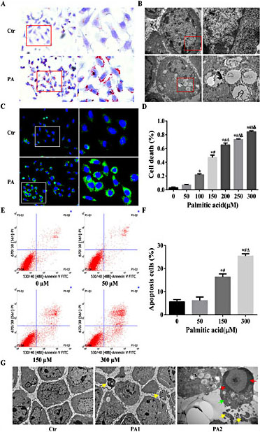 Palmitic Acid-Induced Podocyte Apoptosis via the Reactive Oxygen ...