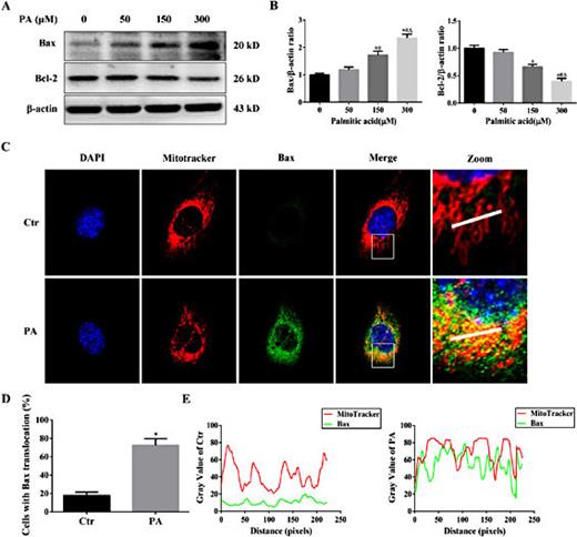 Palmitic Acid-Induced Podocyte Apoptosis via the Reactive Oxygen ...
