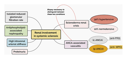 Renal Involvement in Systemic Sclerosis: An Update | Kidney and Blood ...