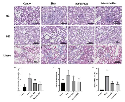 Renal Interstitial Fibrosis Is Reduced in High-Fat Diet-Induced Obese ...