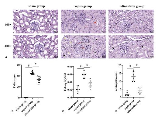 Ulinastatin Improves Renal Microcirculation by Protecting Endothelial ...