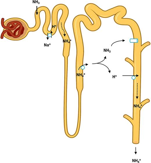 Urine pH and Urine Ammonium as Biomarkers in Kidney Disease | Kidney ...