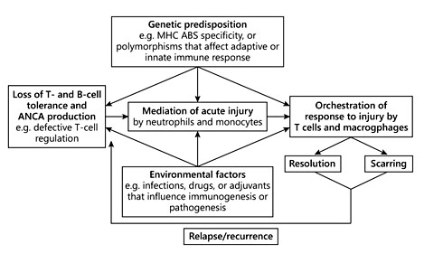 Overview of the Pathogenesis of ANCA-Associated Vasculitis | Kidney ...