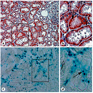 Signaling Crosstalk between Tubular Epithelial Cells and Interstitial ...