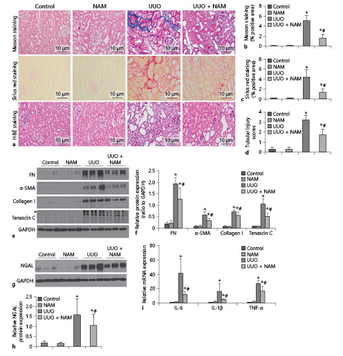 Nicotinamide Supplementation Attenuates Renal Interstitial Fibrosis via ...