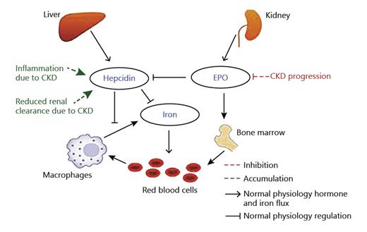 Erythropoietin-Stimulating Agent Hyporesponsiveness in Patients Living ...