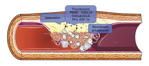Activated Platelets, the Booster of Chronic Kidney Disease and ...