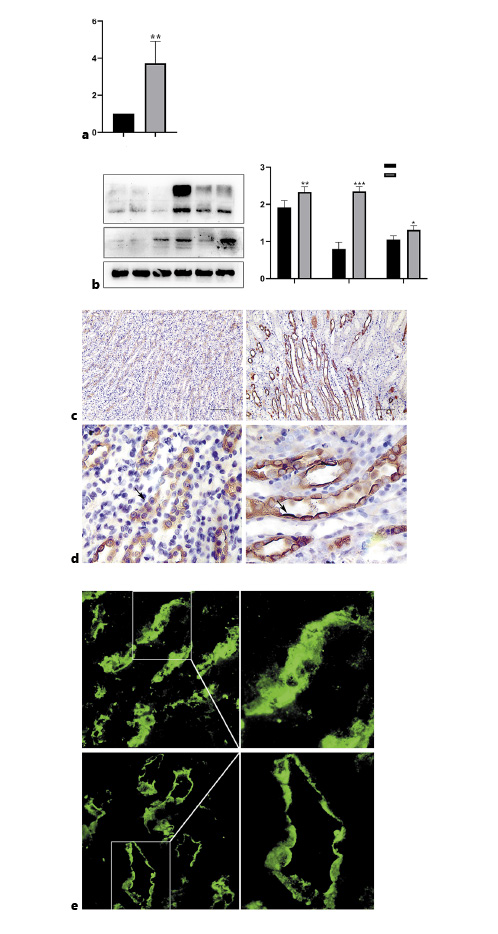 Loss of Pten in Renal Tubular Cells Leads to Water Retention by ...