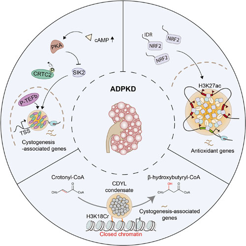 Phase Separation in Kidney Diseases: Autosomal Dominant Polycystic ...