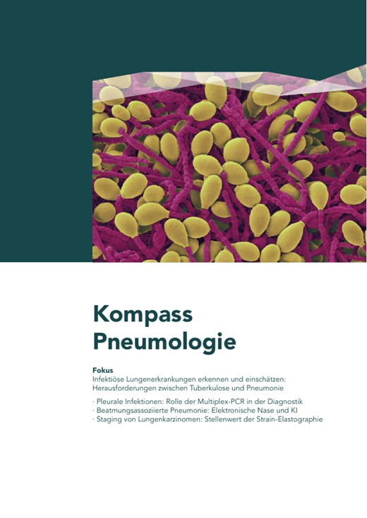 Kombinierte Lungenfibrose und Emphysem: Exazerbationen für die Prognose ...