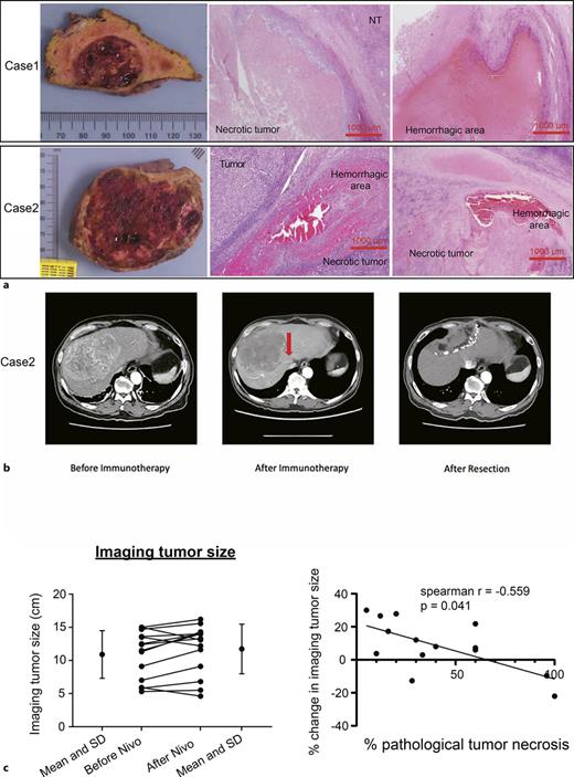 Multimodal Integrative Genomics and Pathology Analyses in Neoadjuvant ... Multimodal Integrative Genomics and Pathology Analyses in Neoadjuvant ...