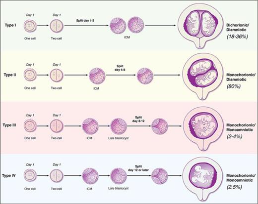 Epigenetics as the Underlying Mechanism for Monozygotic Twin ...