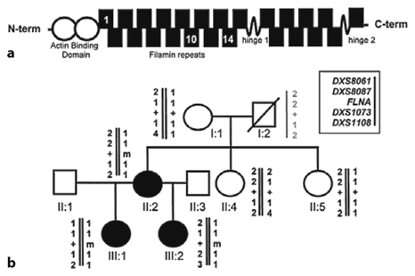 Expansion of the Spectrum of FLNA Mutations Associated with Melnick ...